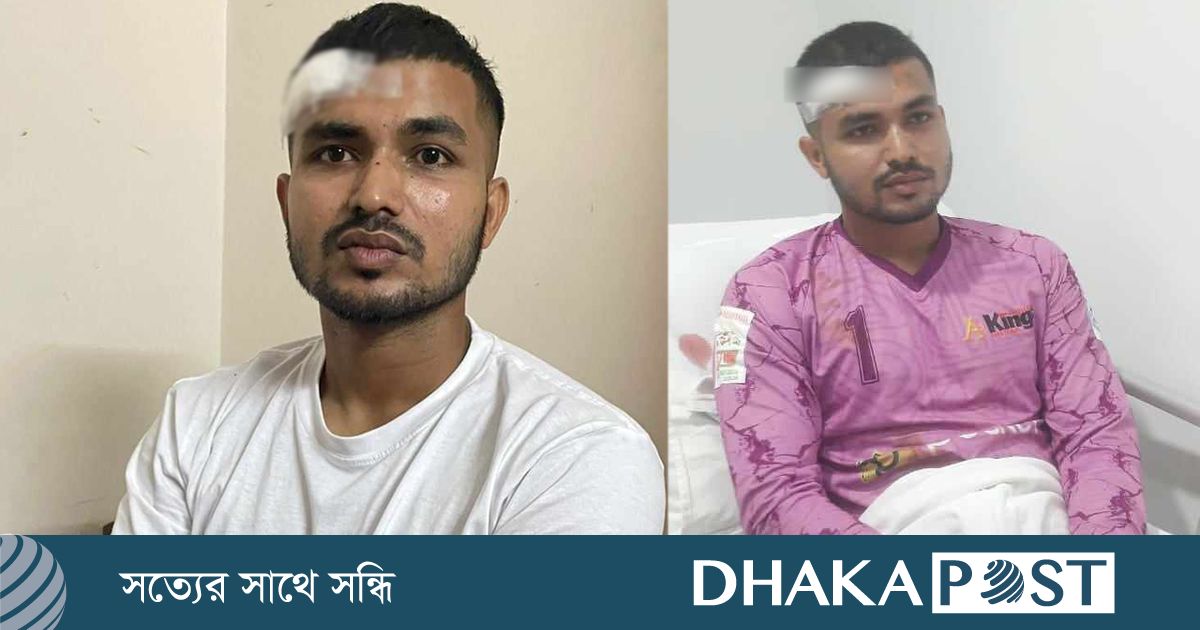 কসমেটিক সার্জারির পর ক্লাবে ফিরলেন জিকো