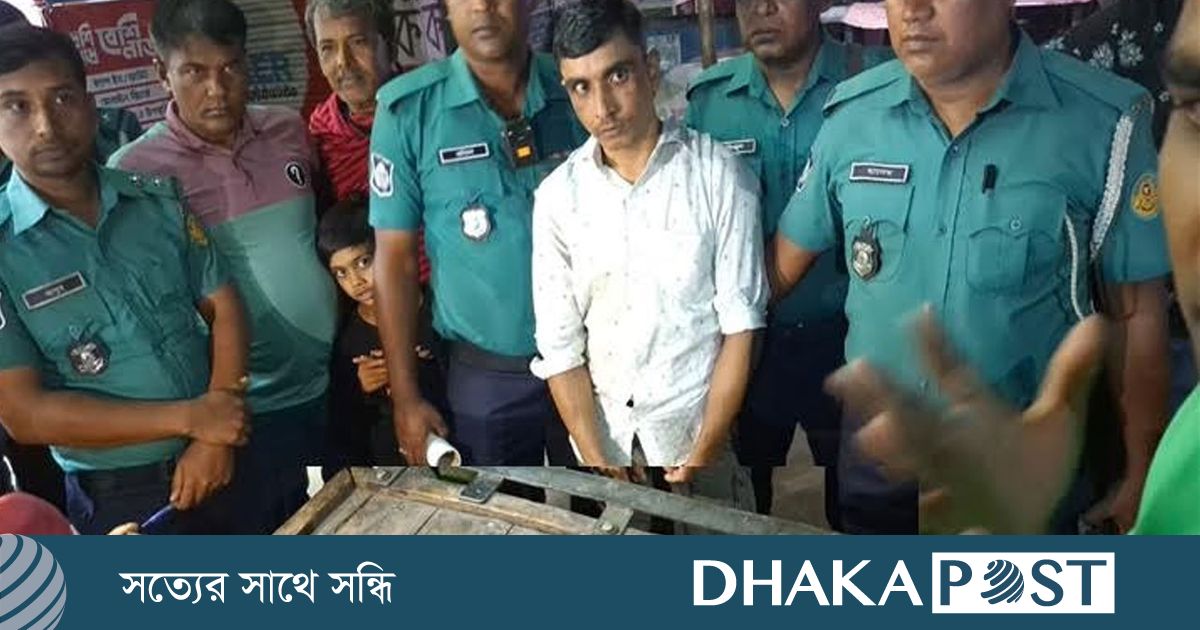 এক্সরে করে পেটের মধ্যে পাওয়া গেল ৮টি স্বর্ণের বার