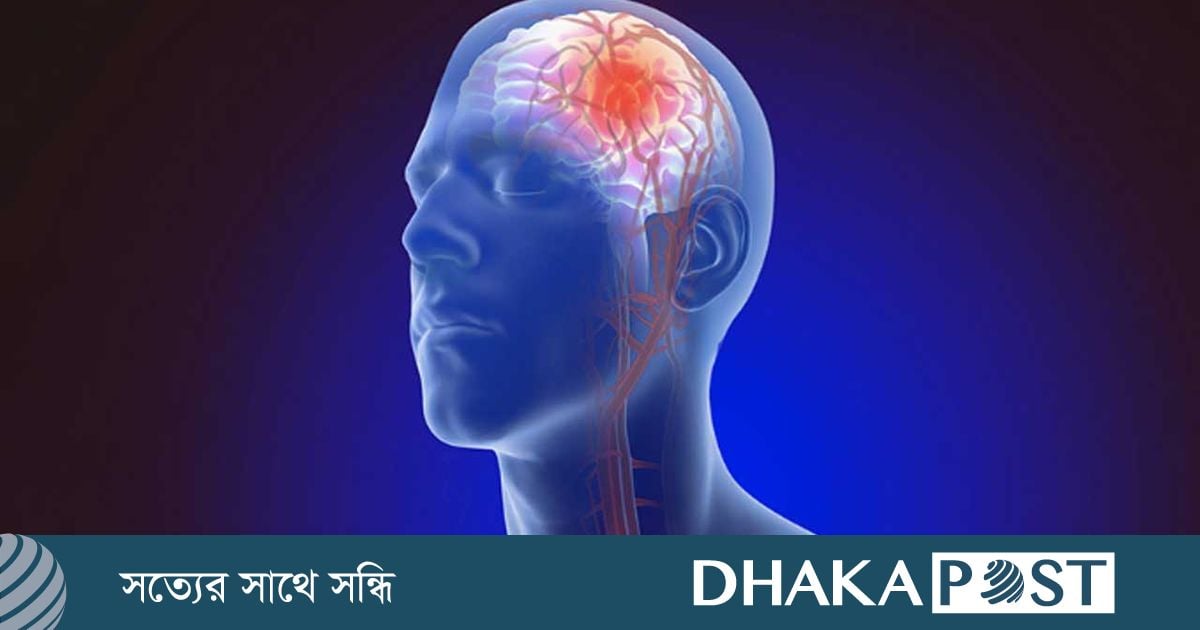 বিশ্ব স্ট্রোক দিবস মঙ্গলবার